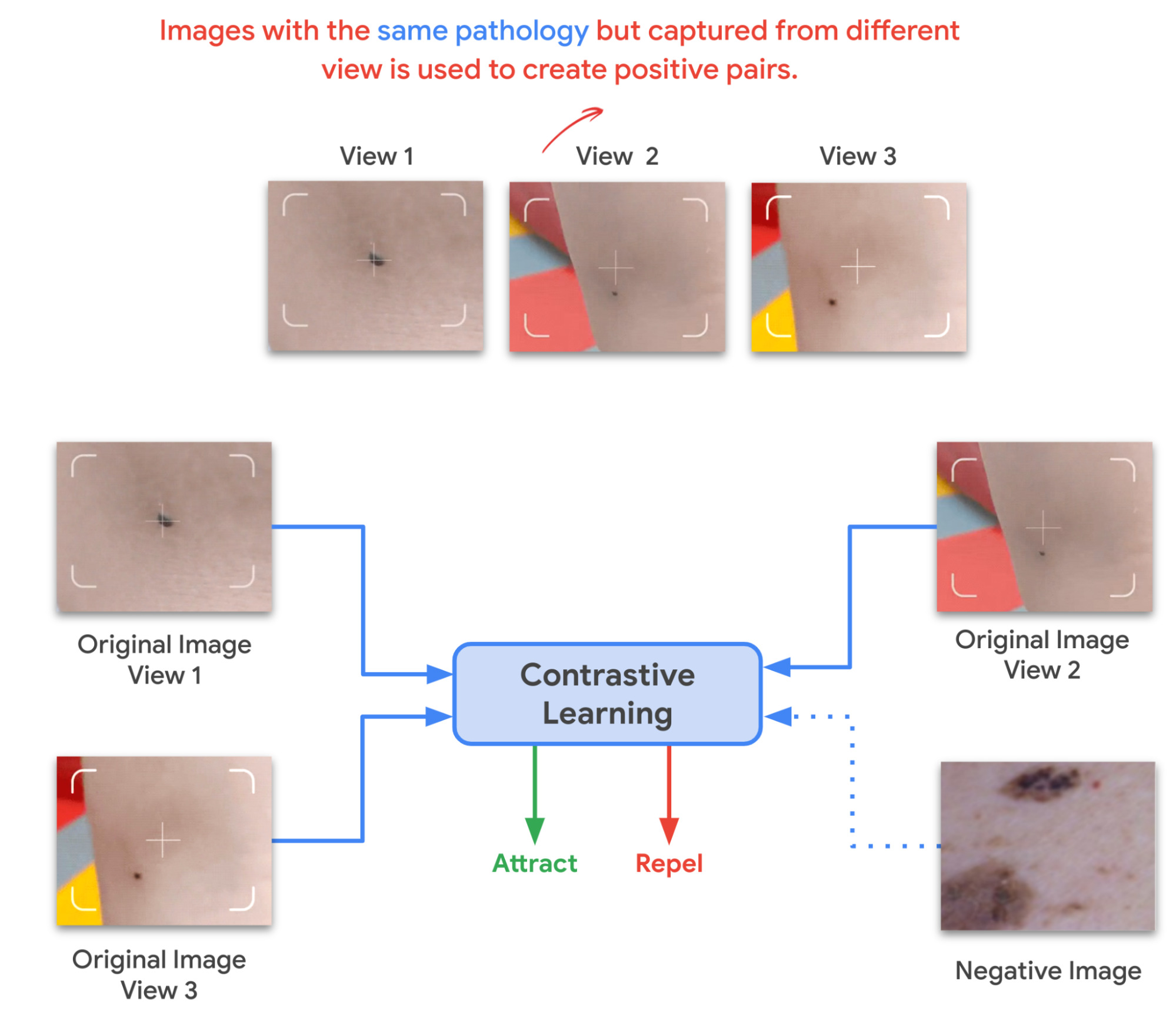 MICLe:自己教師あり学習で医療用画像の分類精度を向上(2/3)